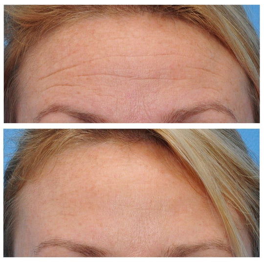 Best Cosmetic Dermatologist San Francisco | Dr. Caren Campbell ...
